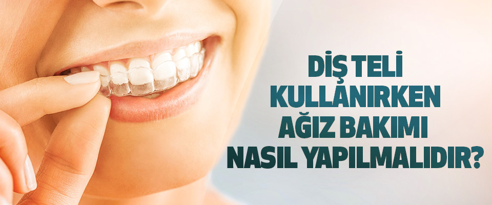Diş Teli Kullanırken Ağız Bakımı Nasıl Yapılmalıdır?